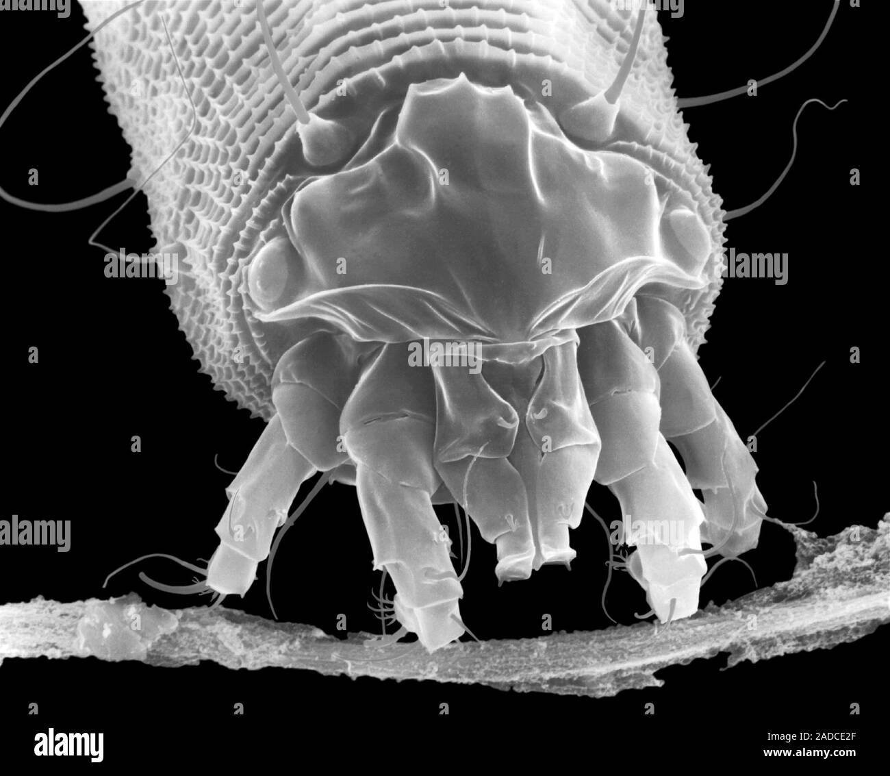 Scanning electron micrograph (SEM) of Head, legs, and gnathosomal ...