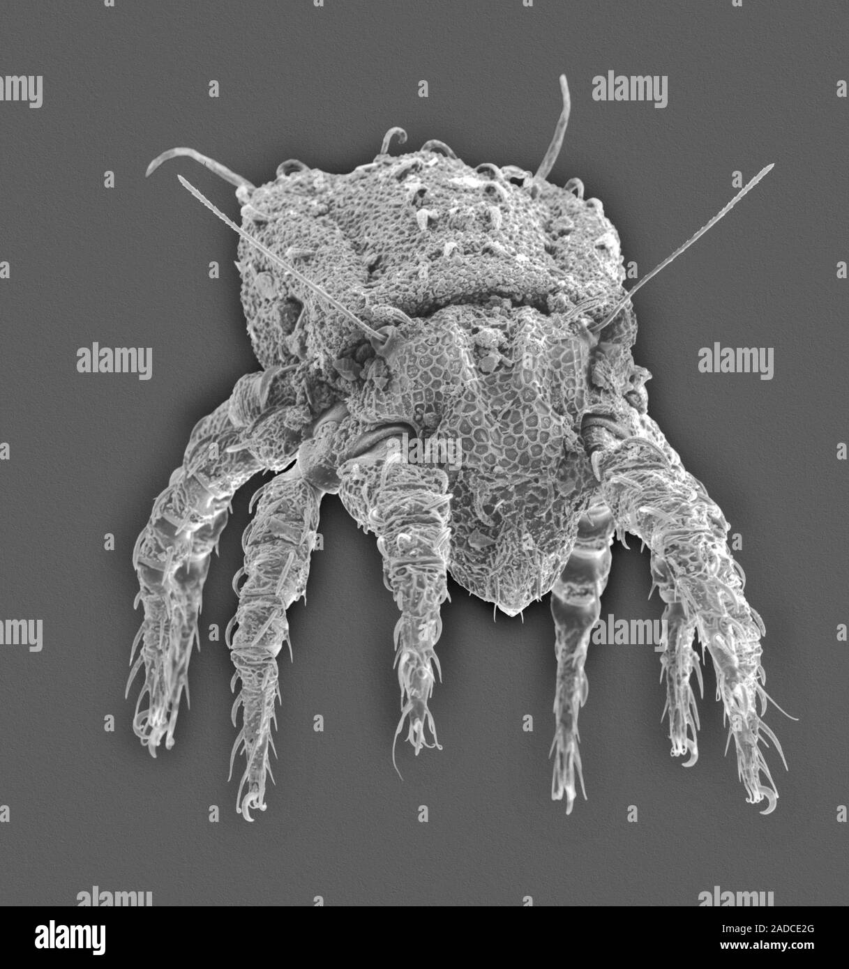 Scanning electron micrograph (SEM) of Soil mite (Northrus sp.). Order ...