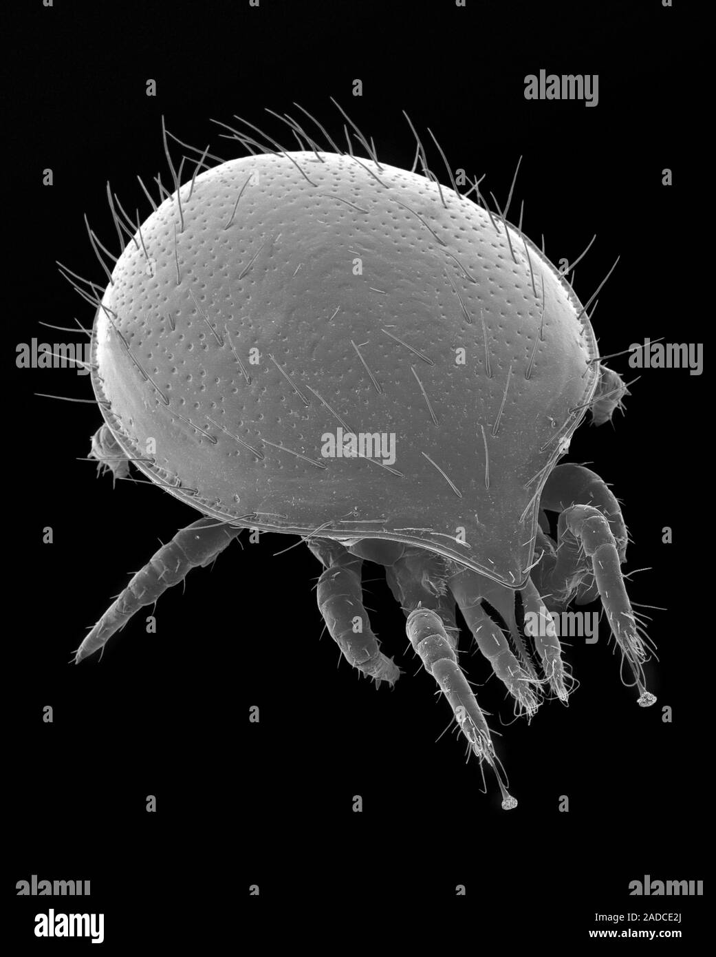 Scanning electron micrograph (SEM) of Tortoise (soil) mite (Uropodina ...