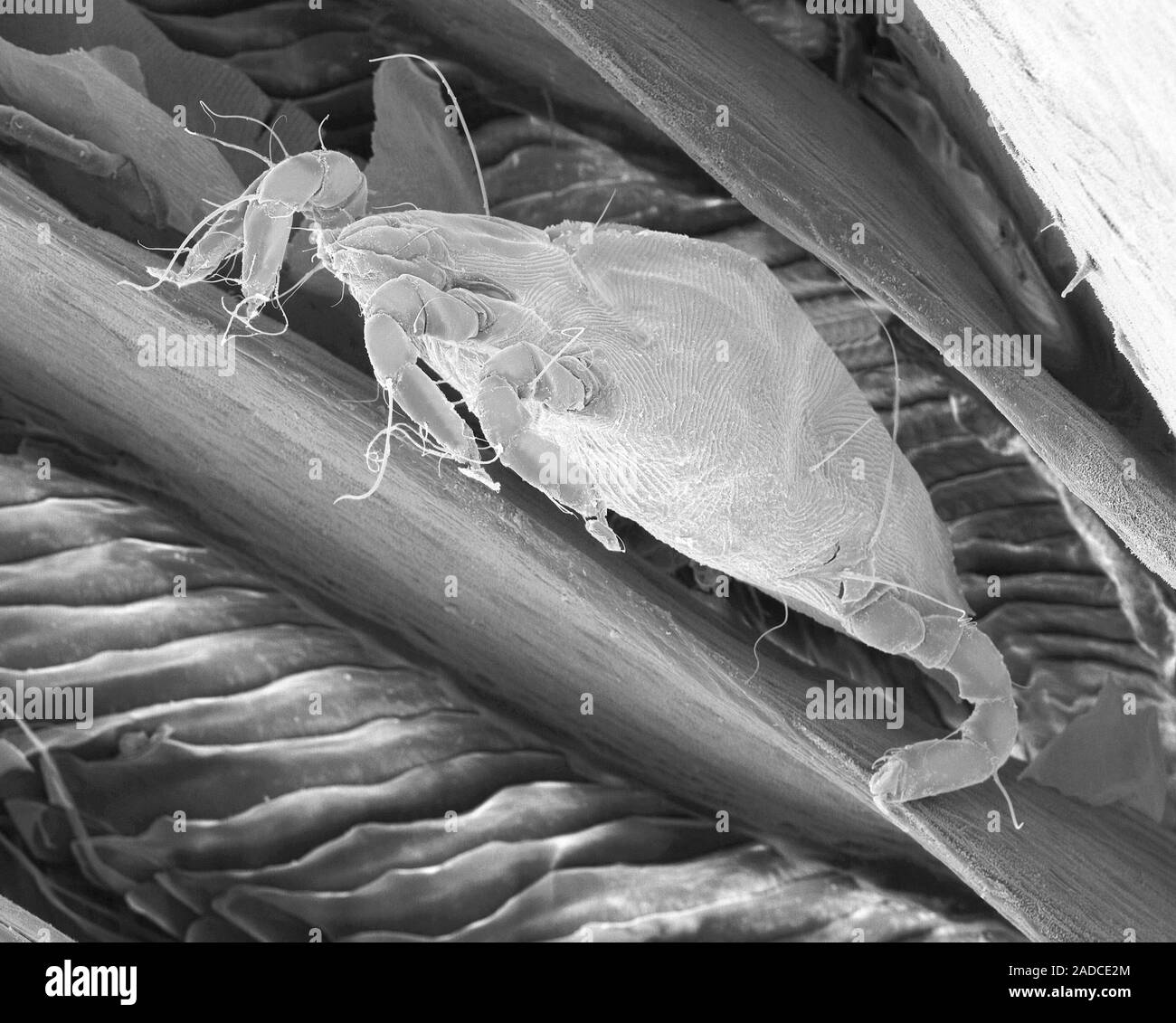 Scanning electron micrograph (SEM) of Bird mite (Ornithonyssus bursa ...