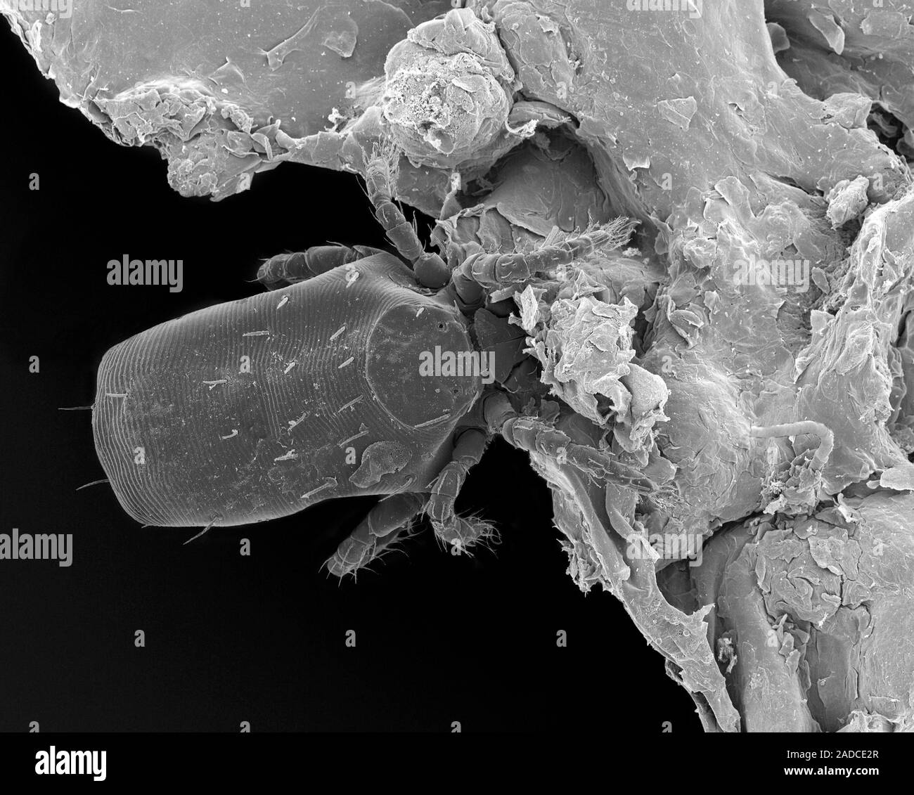 Scanning electron micrograph (SEM) of Chigger, harvest mite larval ...