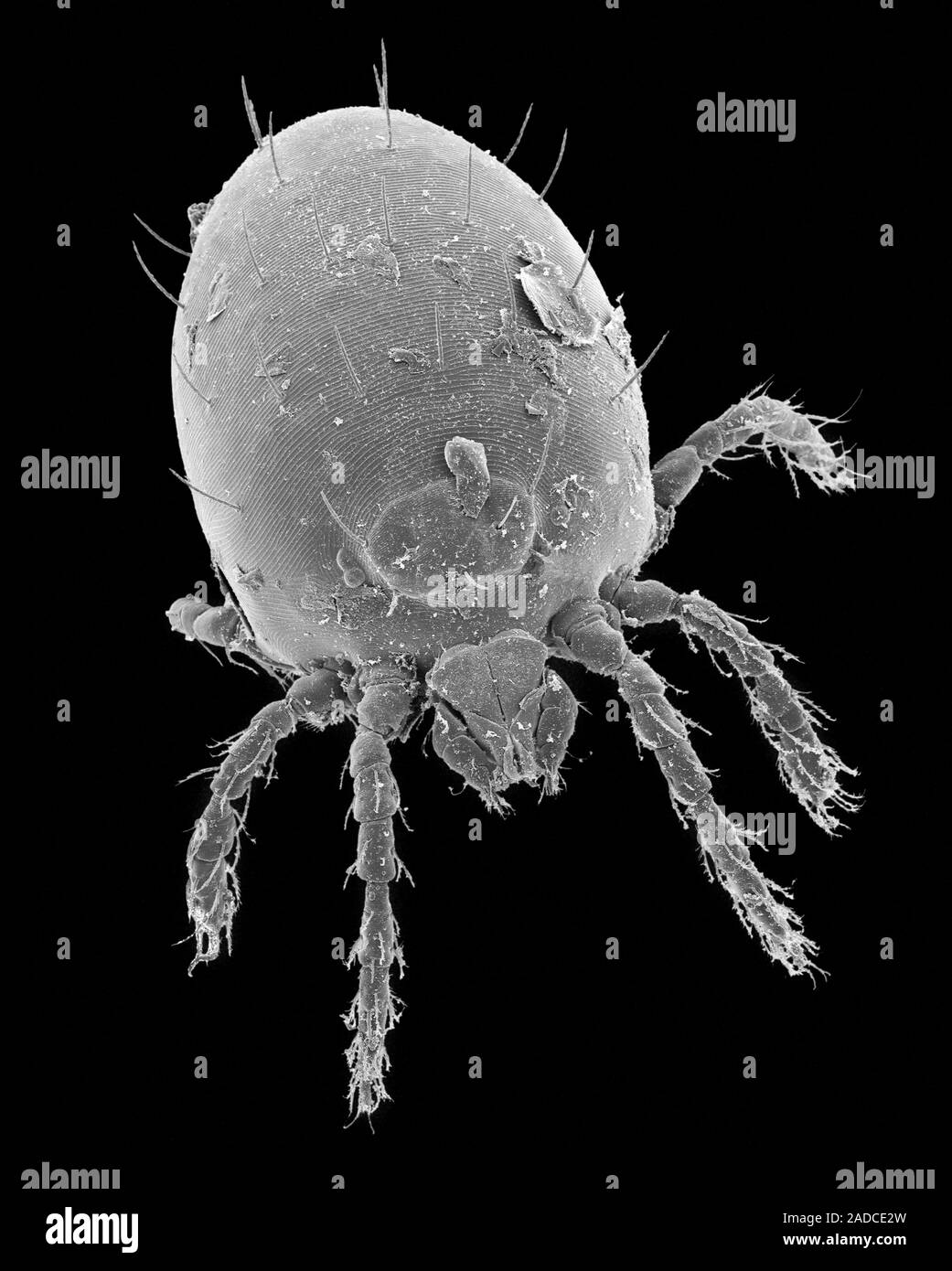 Scanning electron micrograph (SEM) of Chigger (harvest mite larva ...