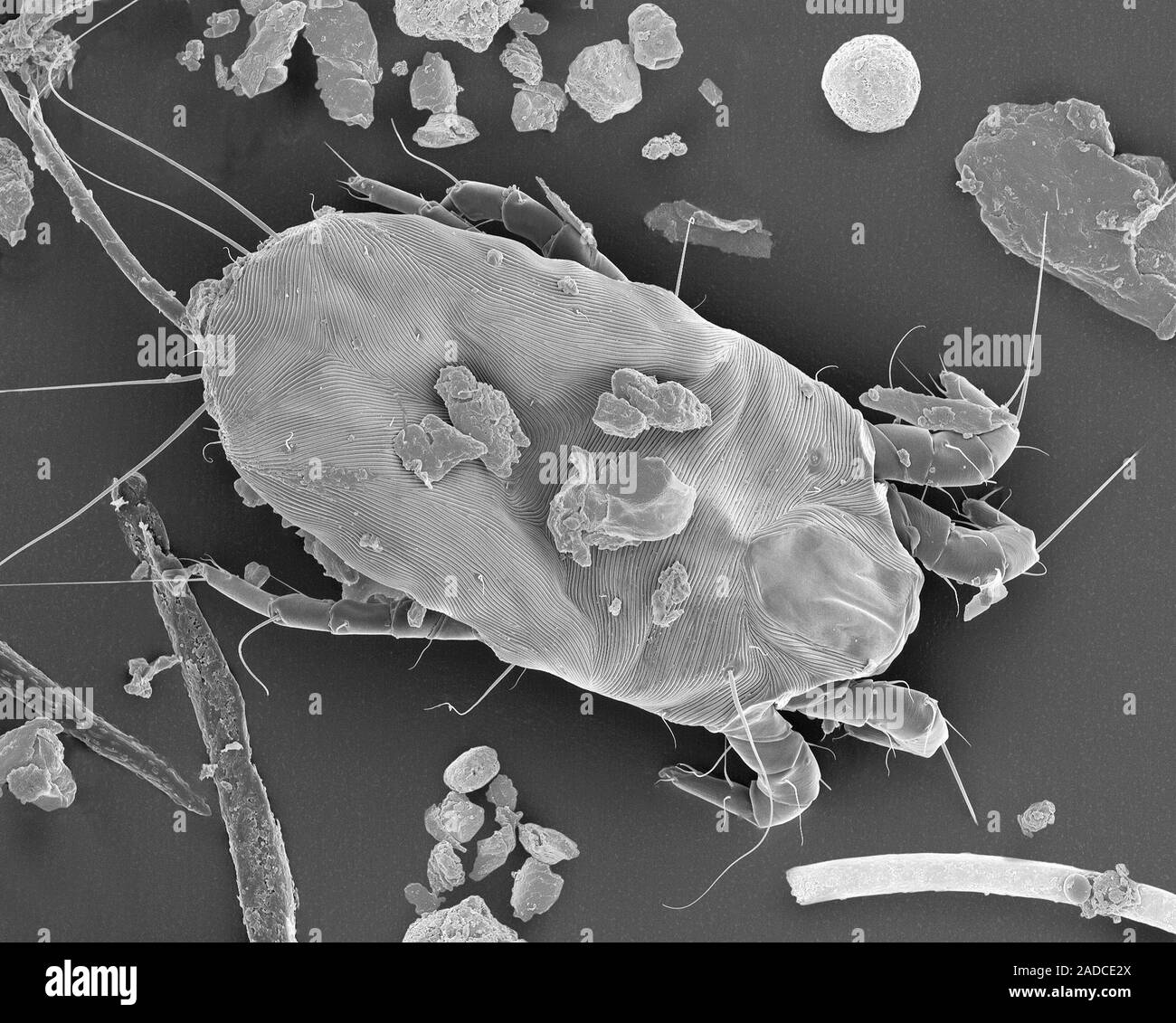 Scanning electron micrograph (SEM) of Dust mite (Dermatophagoides sp ...