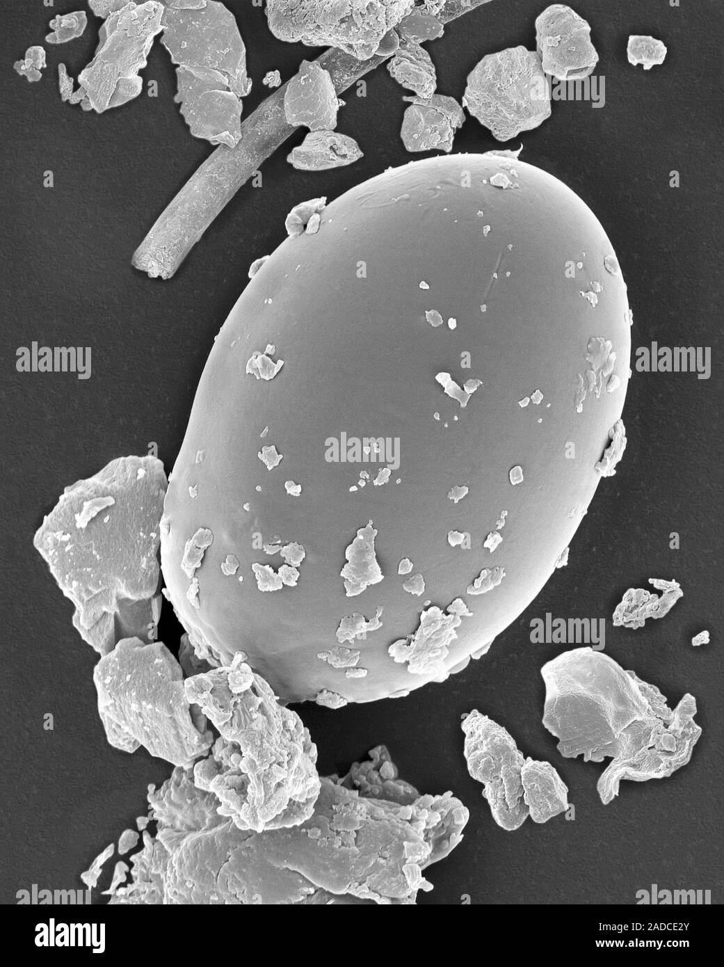Scanning electron micrograph (SEM) of Dust mite egg. (Dermatophagoides ...