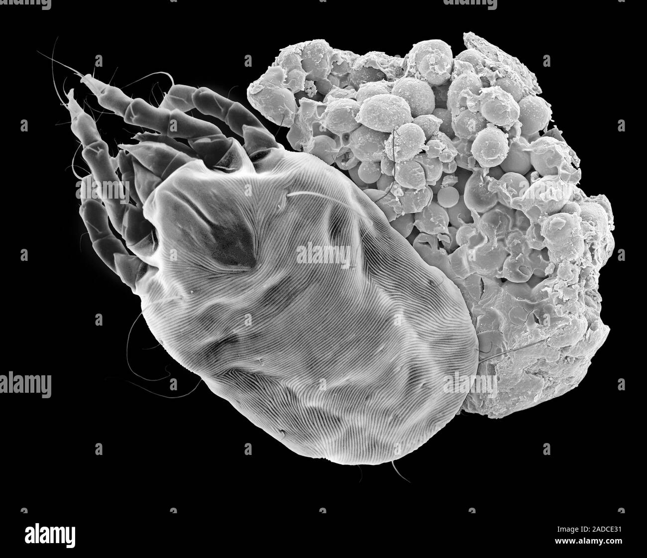 Scanning electron micrograph (SEM) photocomposite of dust mite and dust ...