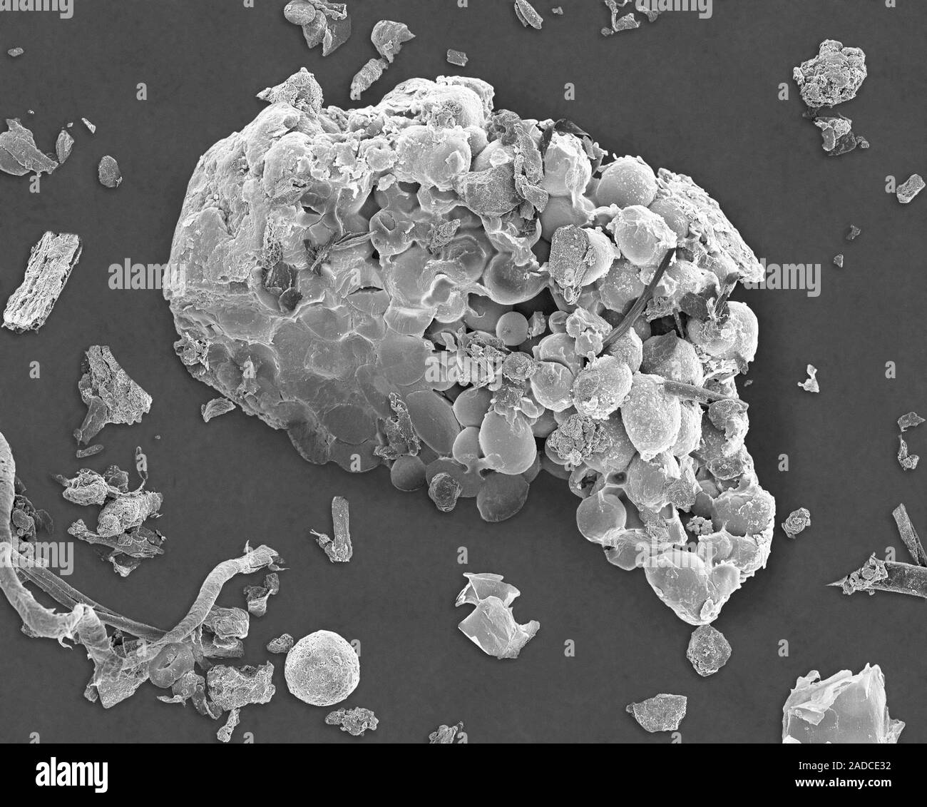 Scanning electron micrograph (SEM) of Dust mite faecal pellet ...
