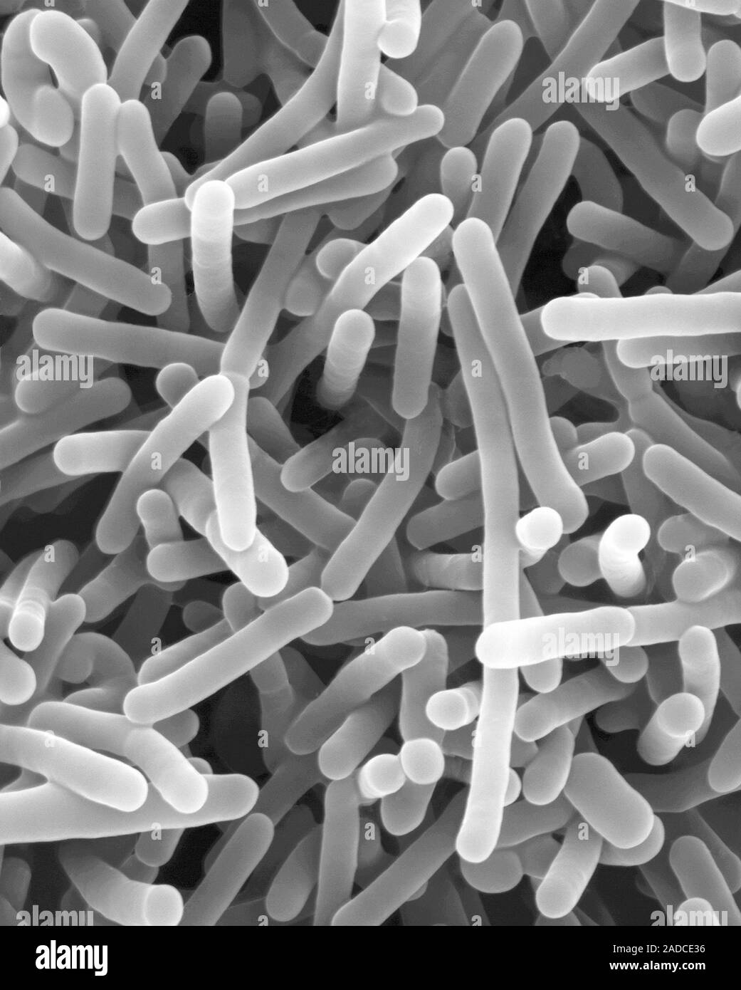 Scanning electron micrograph (SEM) of Listeria monocytogenes, Gram ...