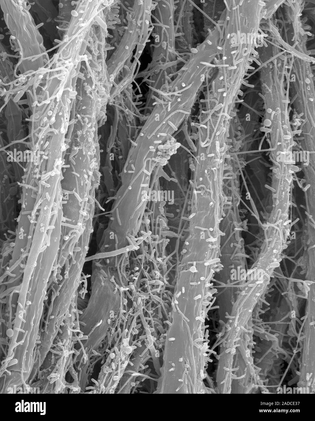 Scanning electron micrograph (SEM) of Filamentous iron-oxidizing ...