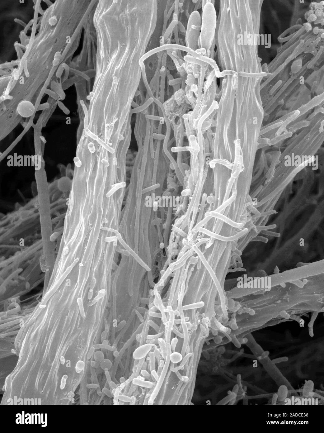Scanning electron micrograph (SEM) of Filamentous iron-oxidizing ...