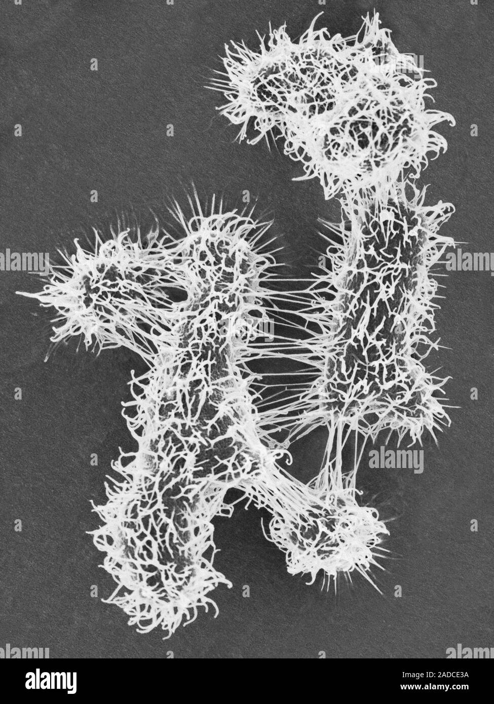 Scanning electron micrograph (SEM) of Labrys wisconsinensis, Gram ...