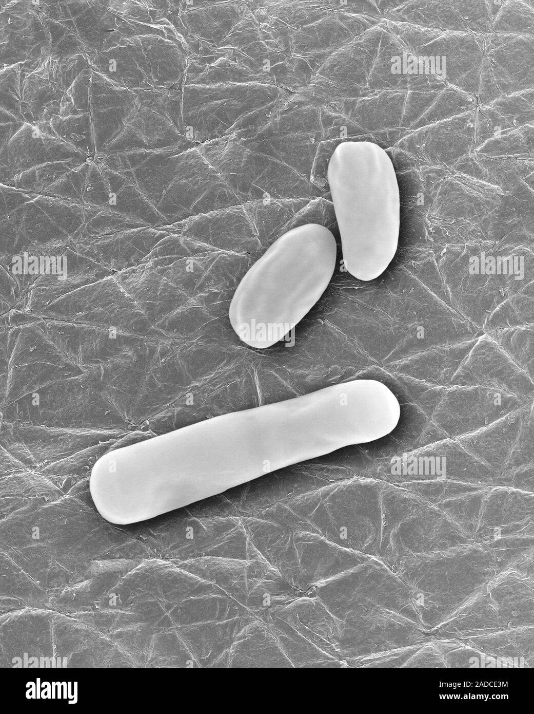 Scanning electron micrograph (SEM) of Bacillus anthracis spore and ...