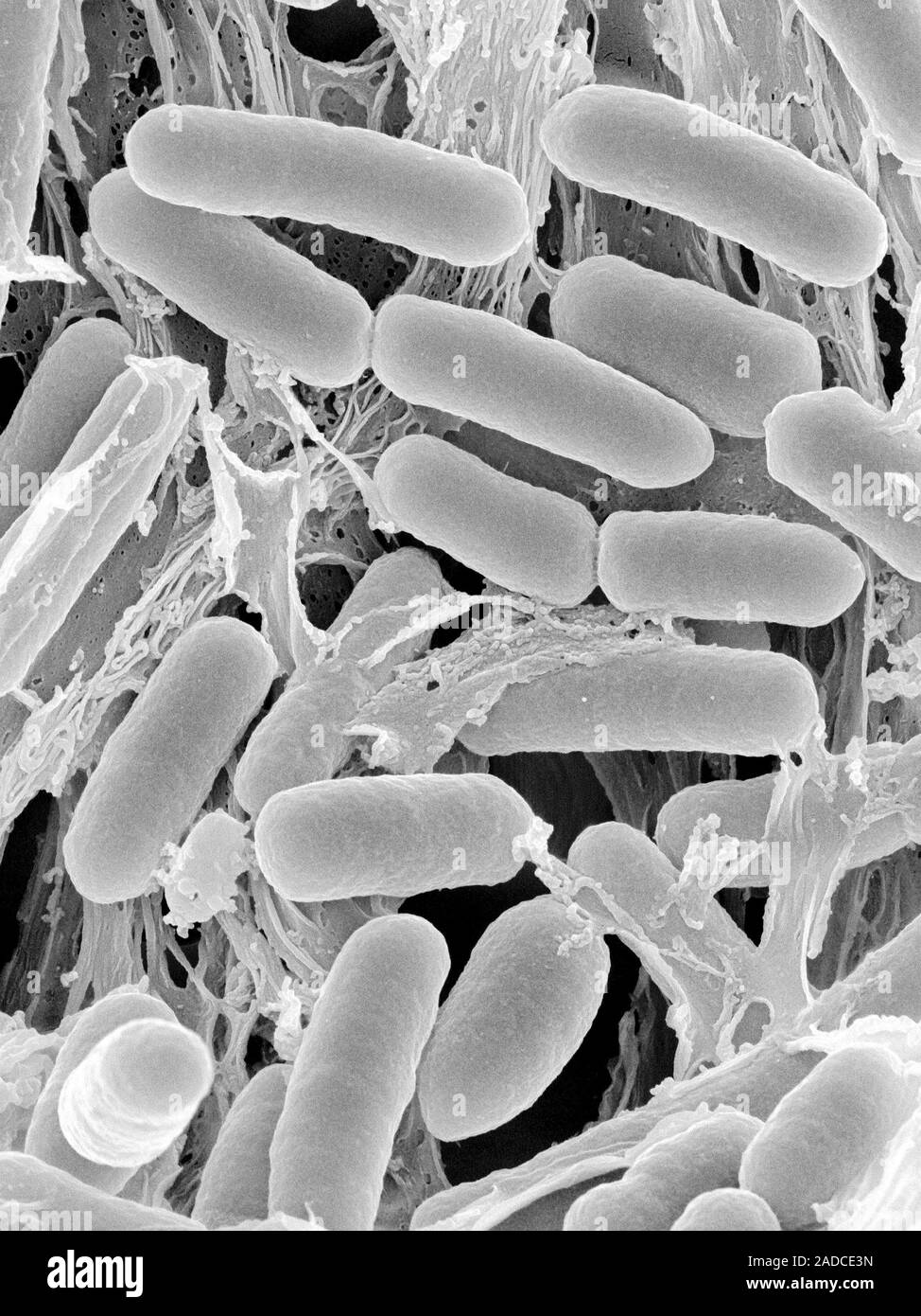 Scanning electron micrograph (SEM) of Escherichia hermannii, Gram ...