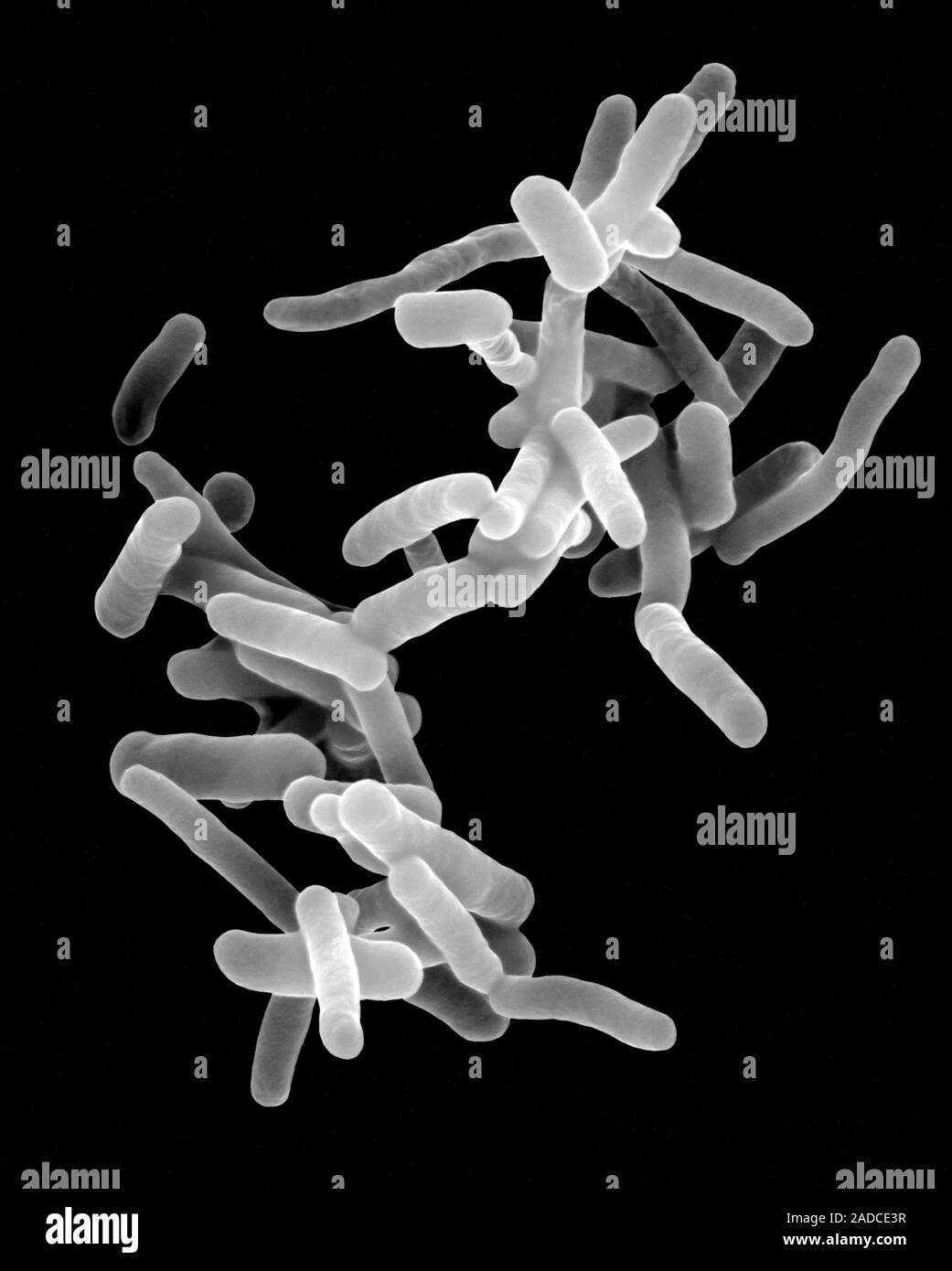 Scanning electron micrograph (SEM) of Shigella dysenteriae, Gram ...