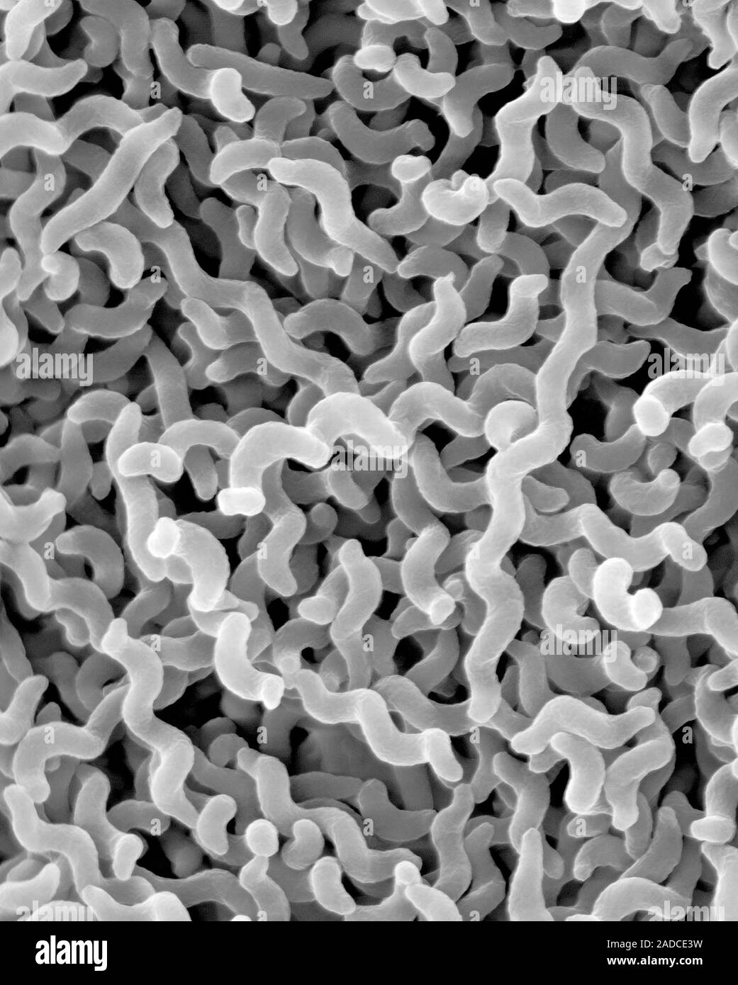 Scanning electron micrograph (SEM) of Campylobacter jejuni is an ...