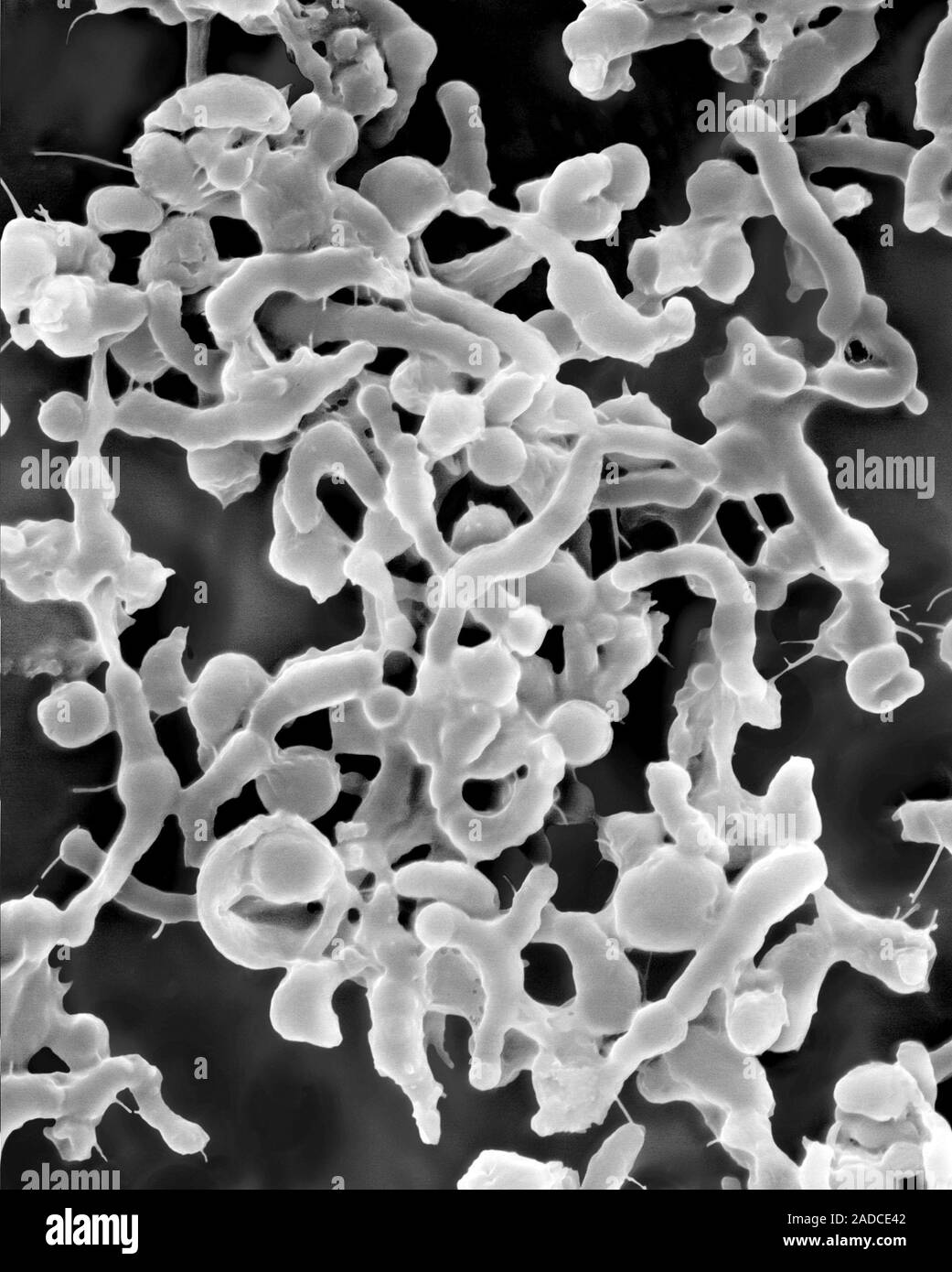 Scanning electron micrograph (SEM) of Helicobacter pylori, Gram ...