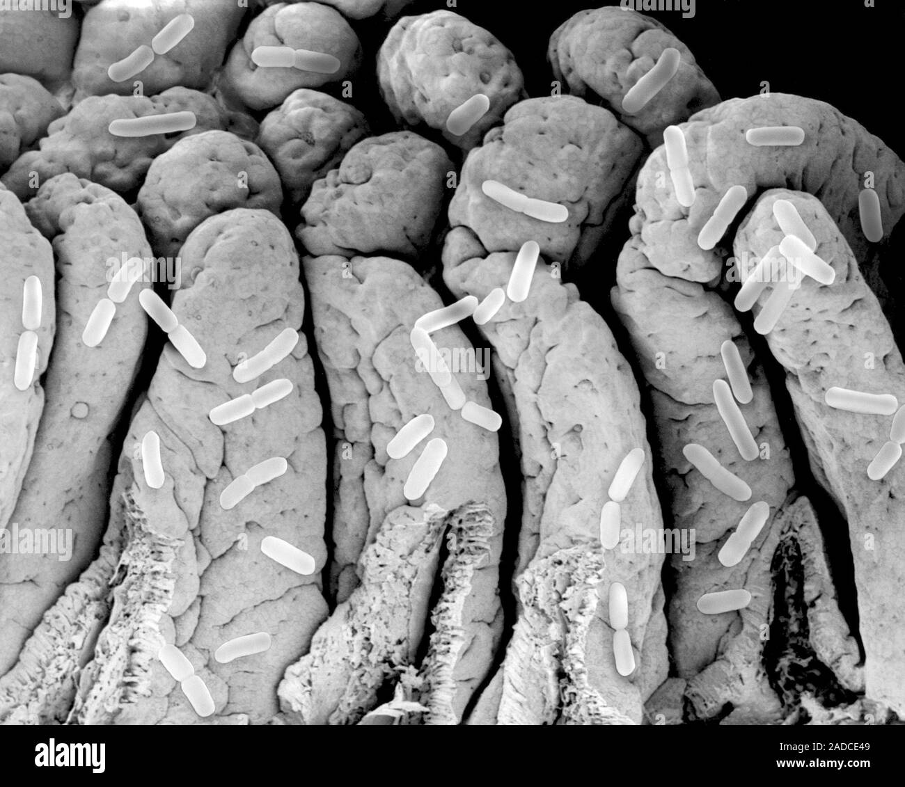 Scanning electron micrograph (SEM) of Photocomposite, E. coli on the ...