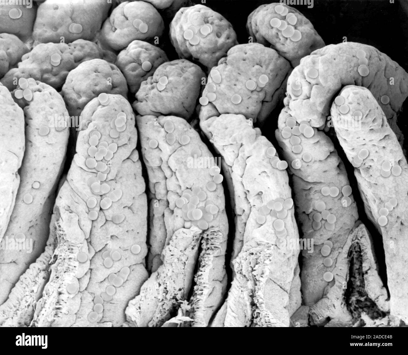 Scanning electron micrograph (SEM) photocomposite of Enterococcus ...