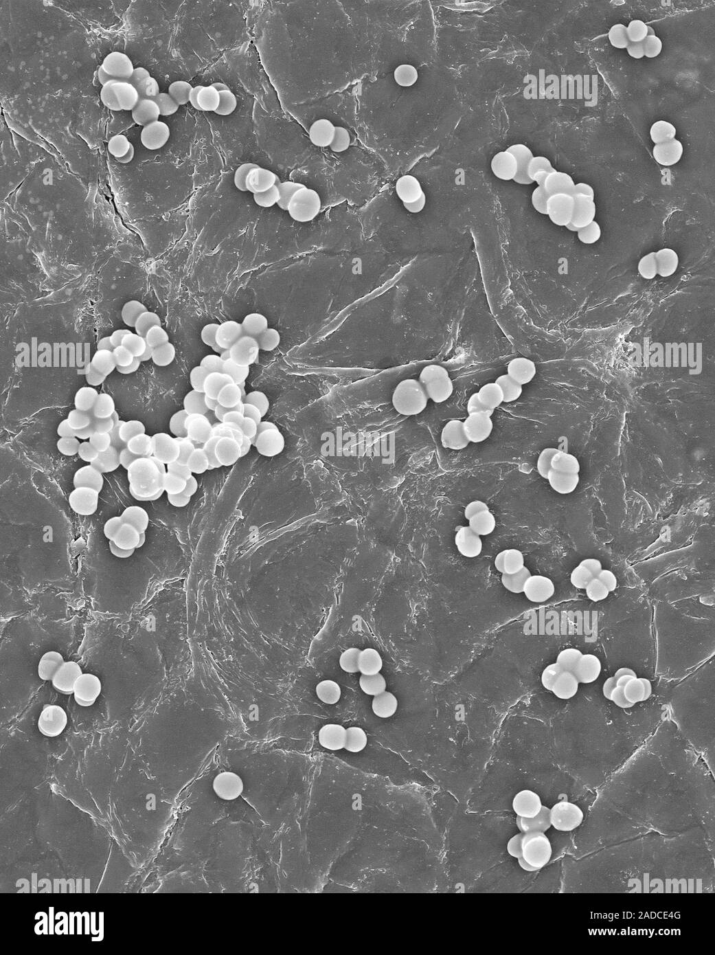 Scanning electron micrograph (SEM) of Photocomposite, Staphylococcus ...