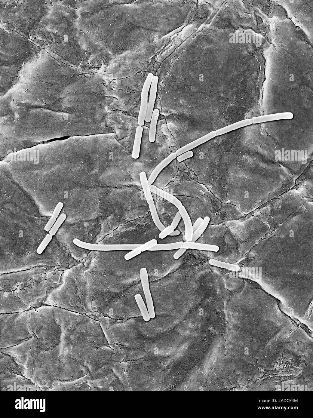Scanning electron micrograph (SEM) of Bacillus anthracis vegetative ...