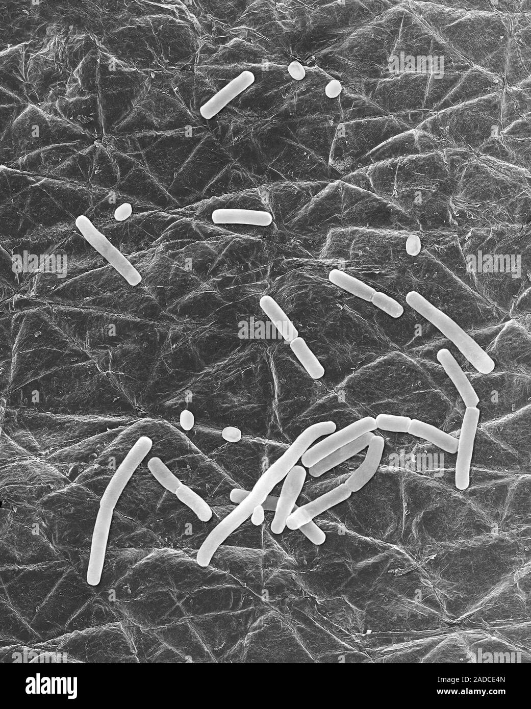 Scanning electron micrograph (SEM) of Bacillus anthracis spore and ...