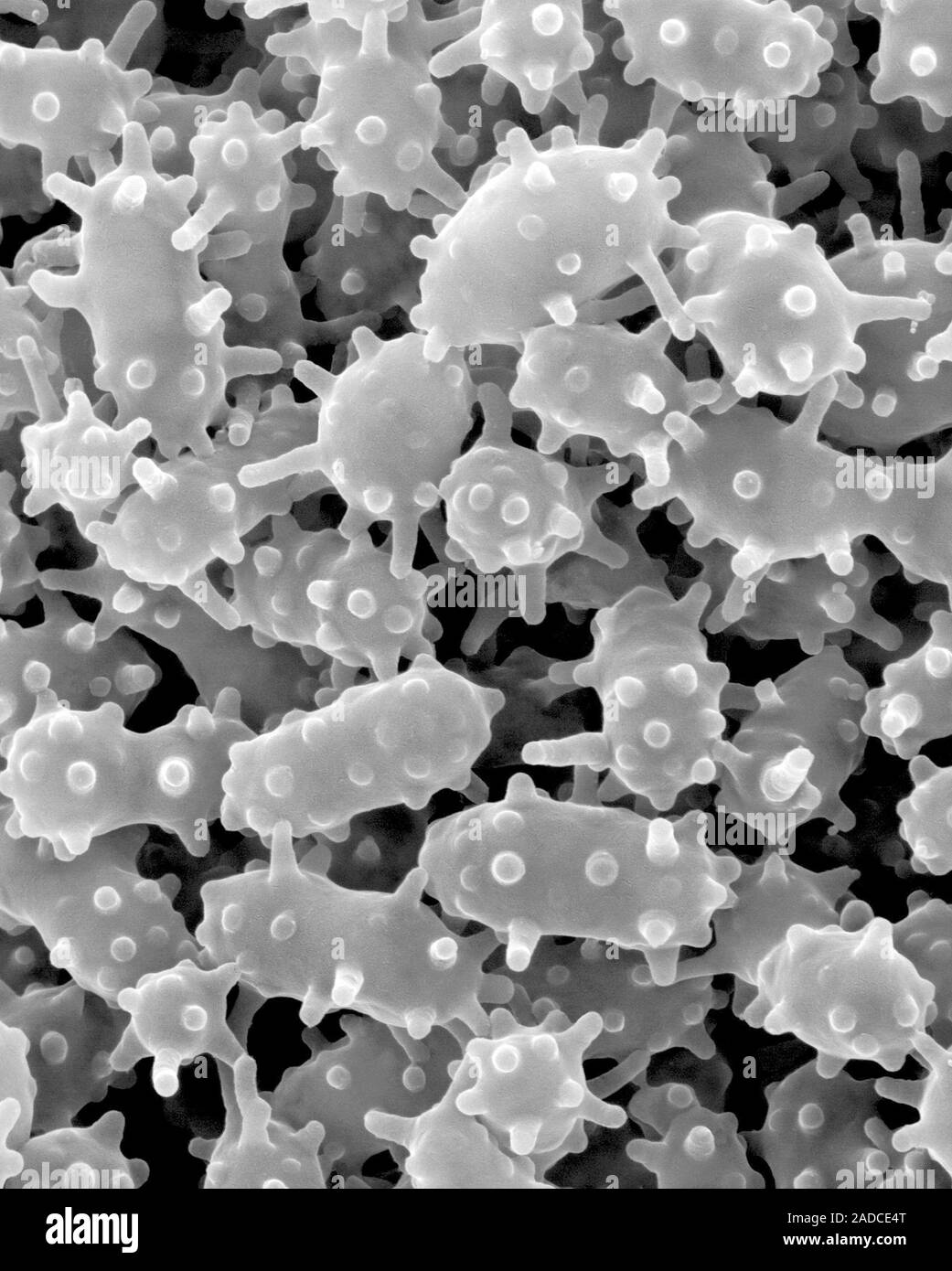 Scanning electron micrograph (SEM) of Verrucomicrobium spinosum ...