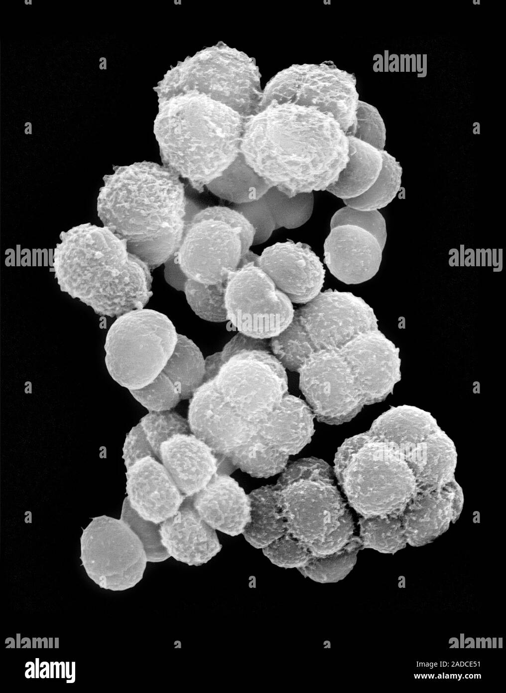 Deinococcus Radiodurans Gram Stain