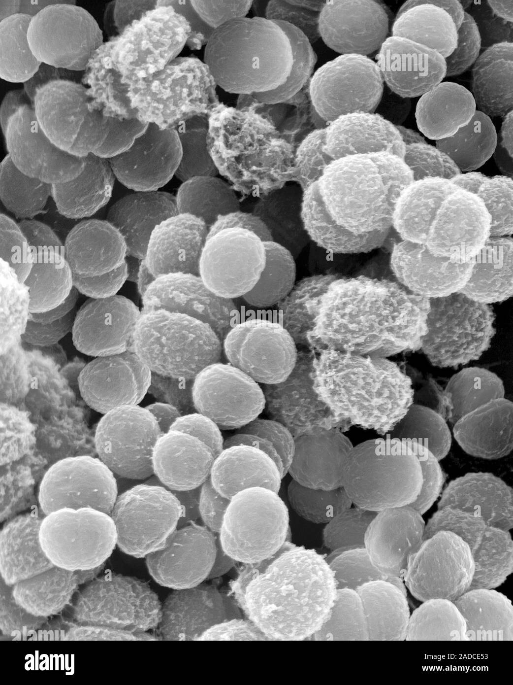 Scanning electron micrograph (SEM) of Deinococcus sp., Coccoid ...