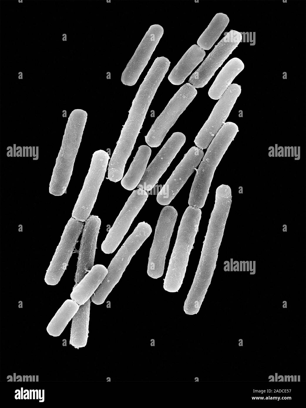 Scanning electron micrograph (SEM) of Clostridium difficile, Gram ...