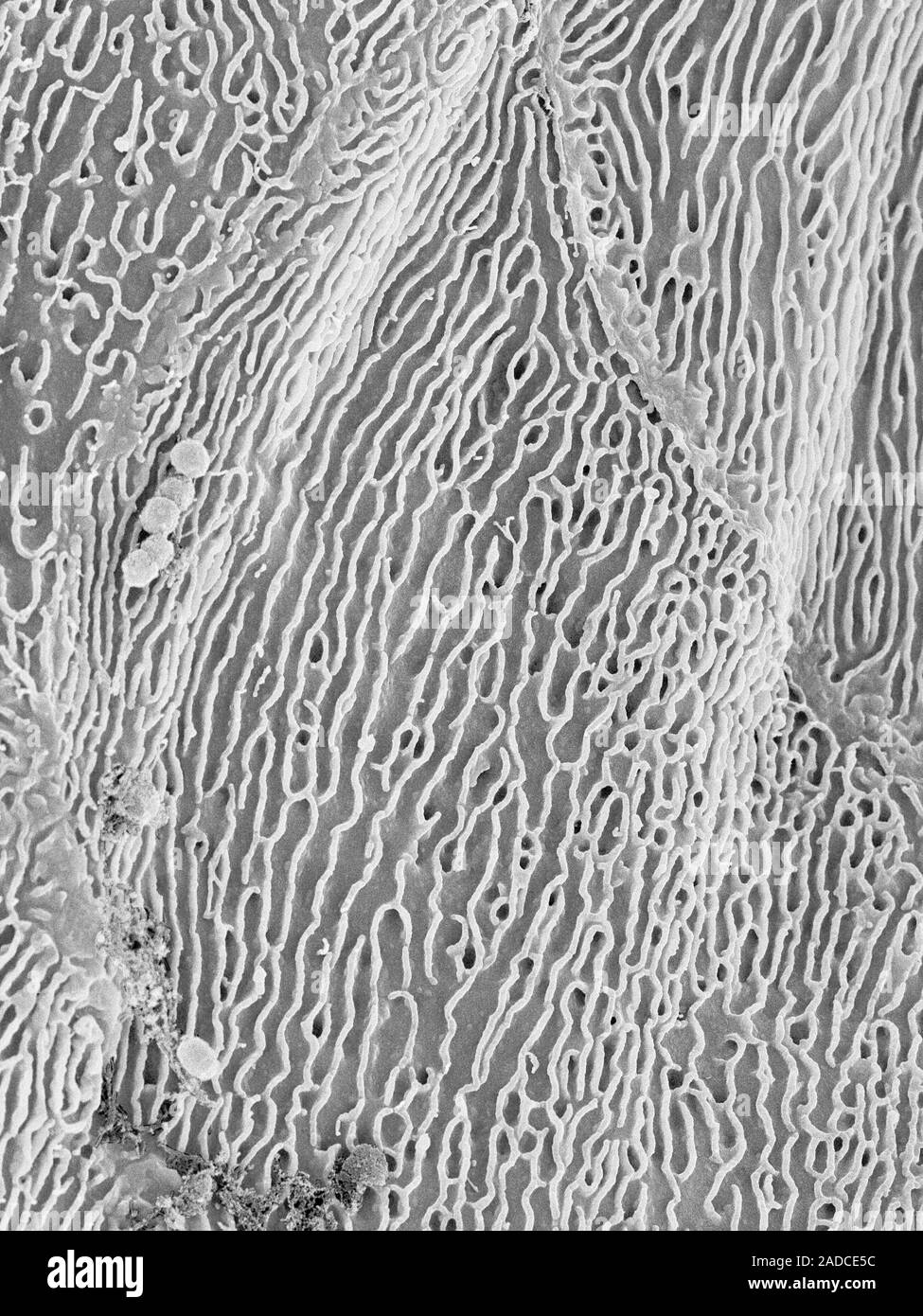 Scanning electron micrograph (SEM) of Bacteria on an epithelial cells ...
