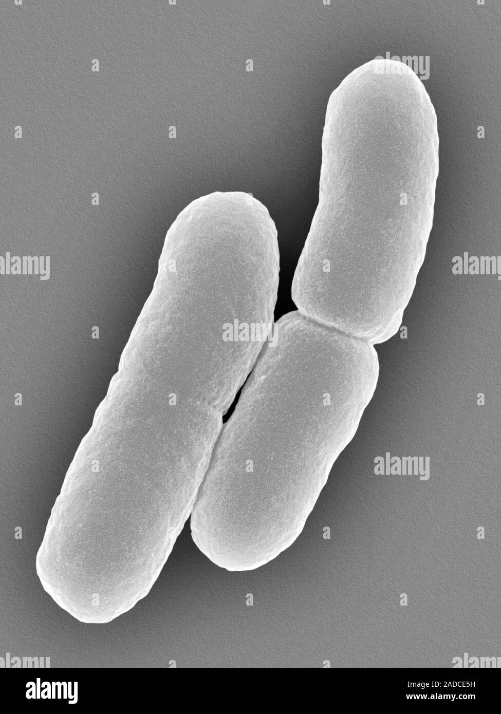 Scanning electron micrograph (SEM) of E. coli (Escherichia coli ...