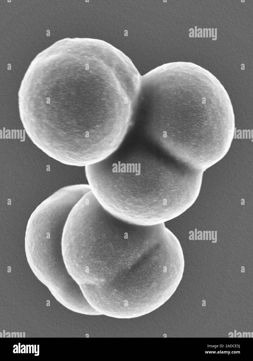 Scanning electron micrograph (SEM) of Staphylococcus aureus, Gram ...