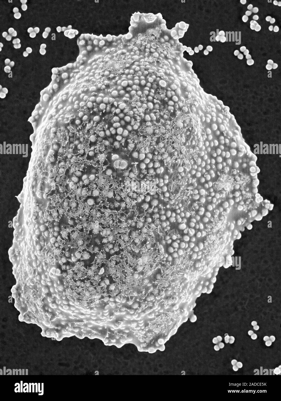 Scanning electron micrograph (SEM) of Staphylococcus aureus colony ...