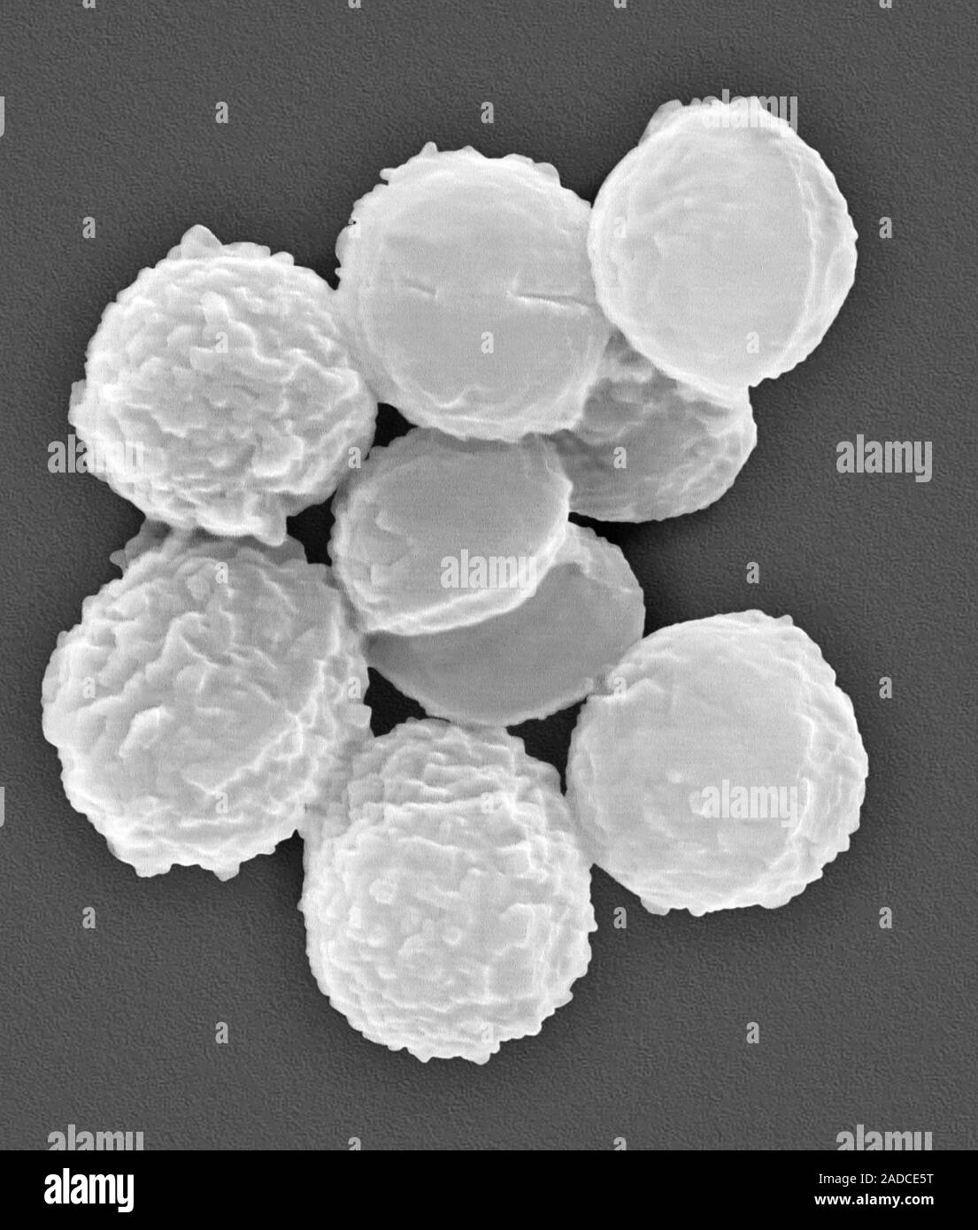Scanning electron micrograph (SEM) of Micrococcus luteus, gram-positive ...