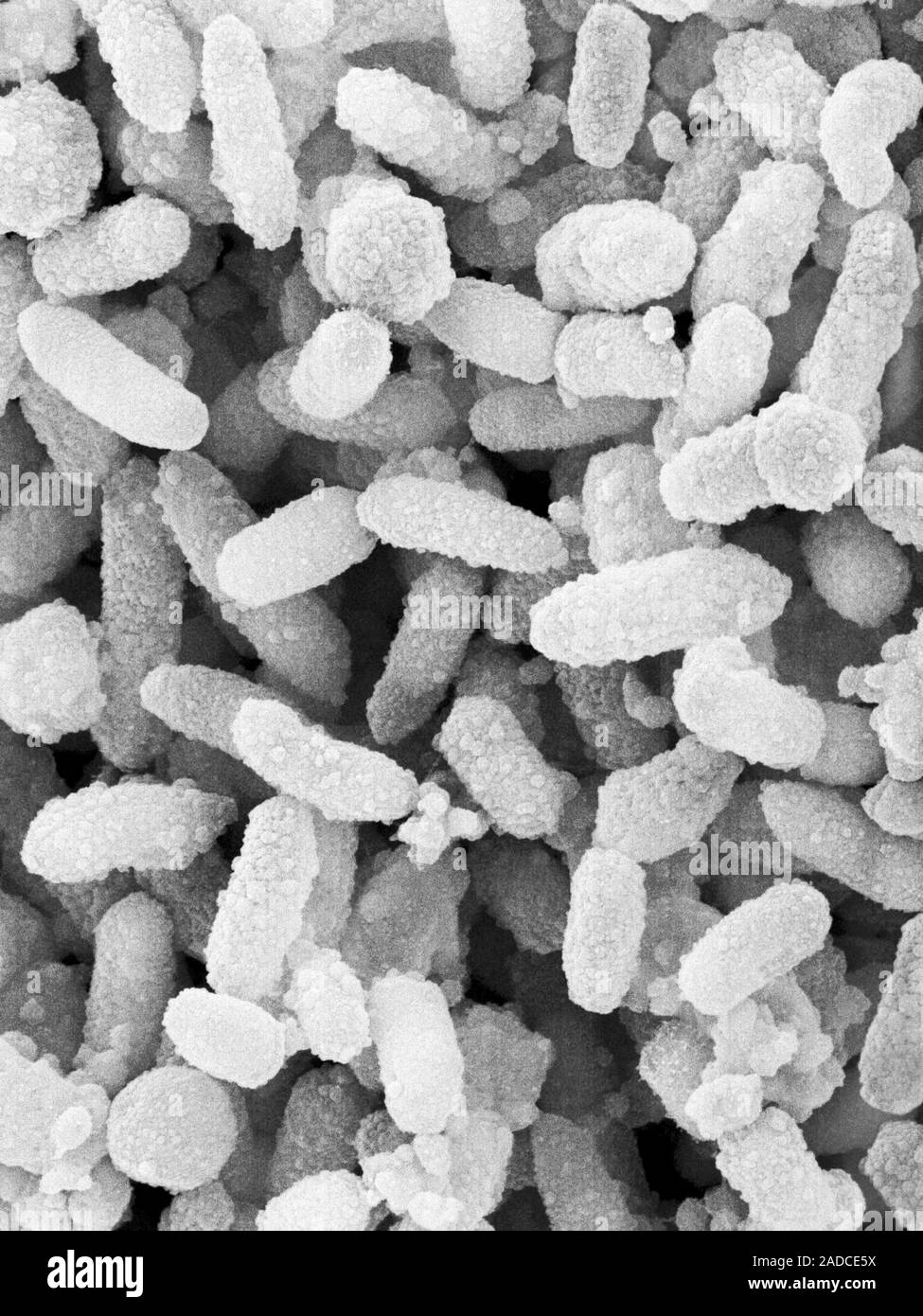 Scanning electron micrograph (SEM) of Aeromonas hydrophila, Gram ...