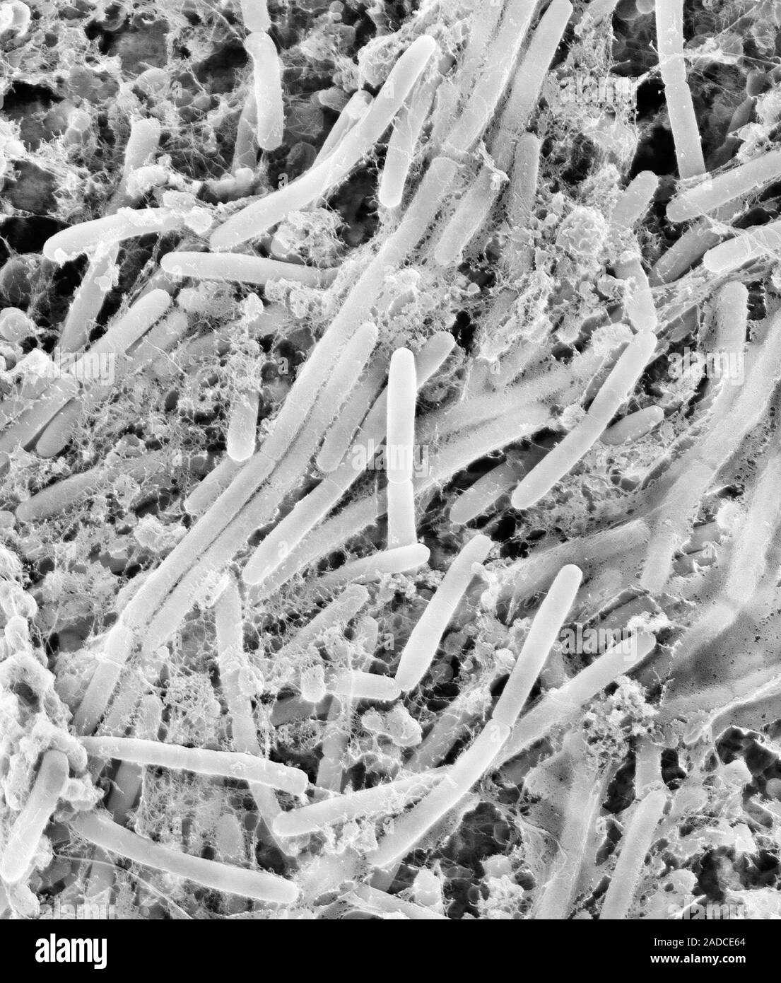 Scanning Electron Micrograph Sem Of Oral Bacterium Actinomyces Viscosus Actinomyces Viscosus