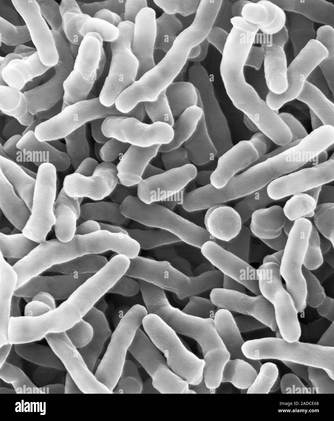 Scanning electron micrograph (SEM) of Propionibacterium acidipropionici ...
