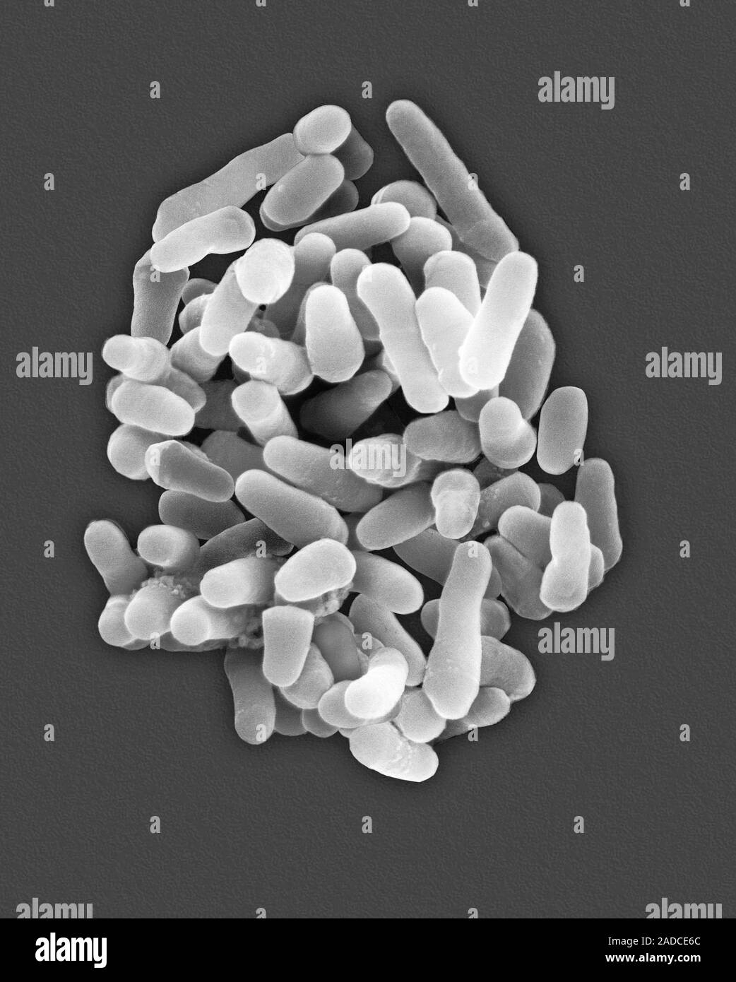 Scanning electron micrograph (SEM) of Mycobacterium tuberculosis, MDR-TB and XDR-TB strain, rod ...