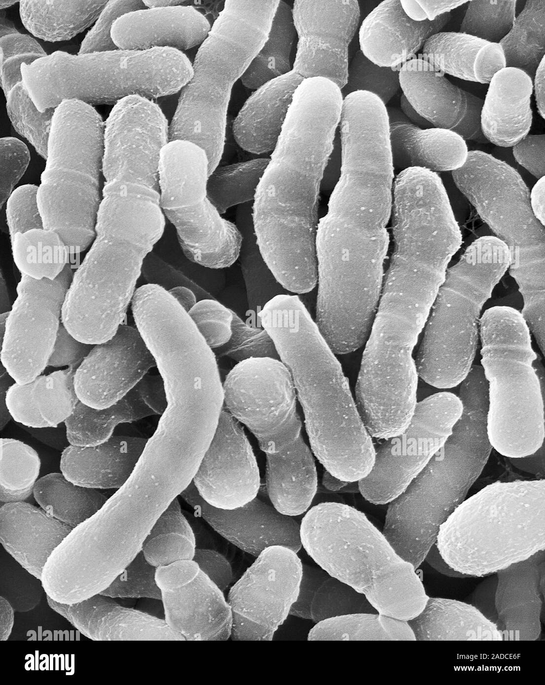 Scanning electron micrograph (SEM) of Corynebacterium ...