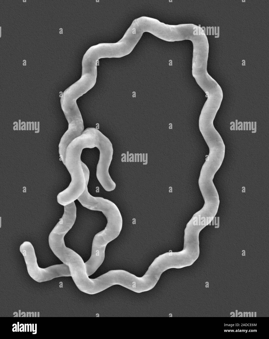 Scanning electron micrograph (SEM) of Marine anaerobic spirillum ...