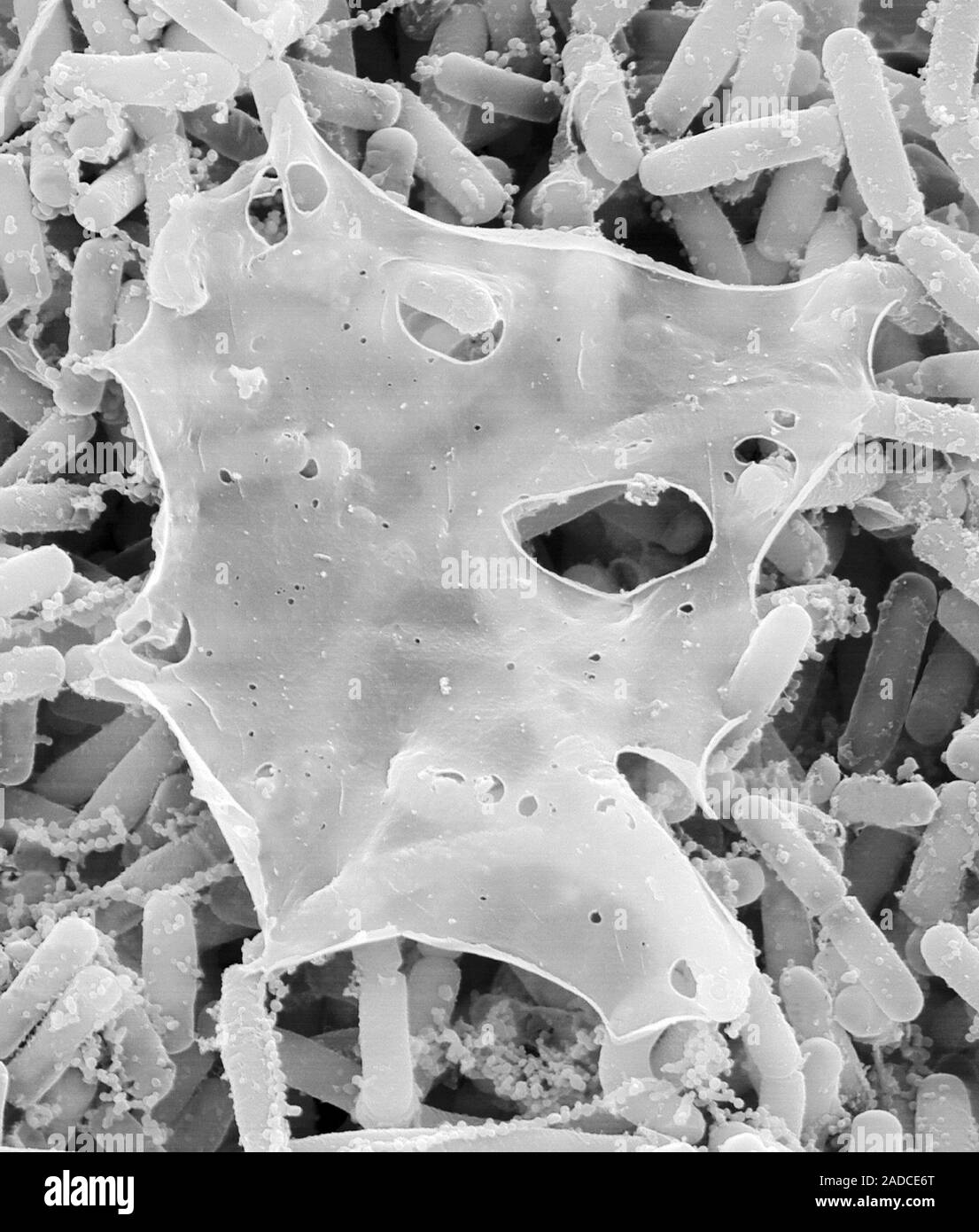 Scanning electron micrograph (SEM) of Streptomyces hygroscopicus, Gram ...