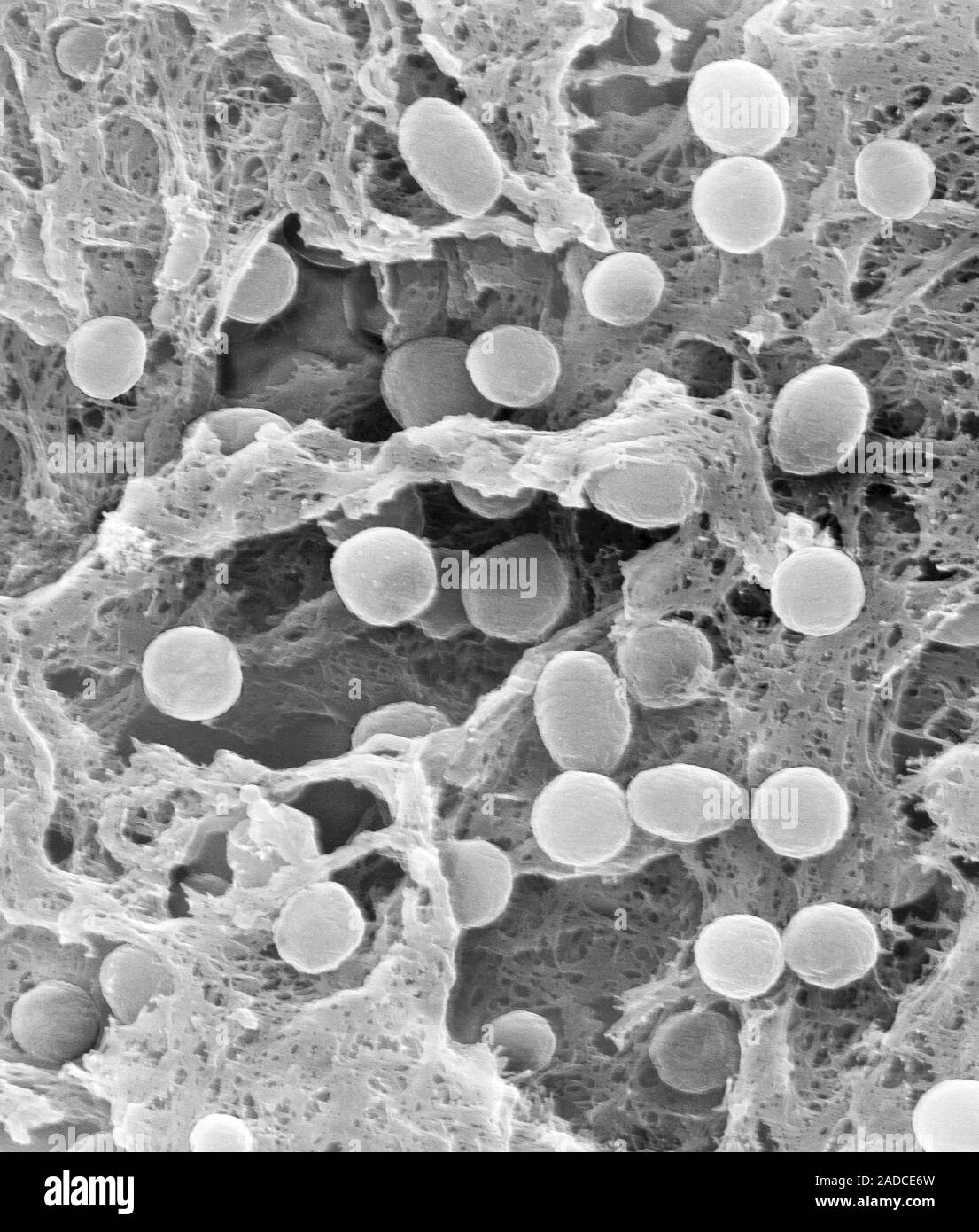 Scanning electron micrograph (SEM) of Acidobacterium sp., coccoid ...