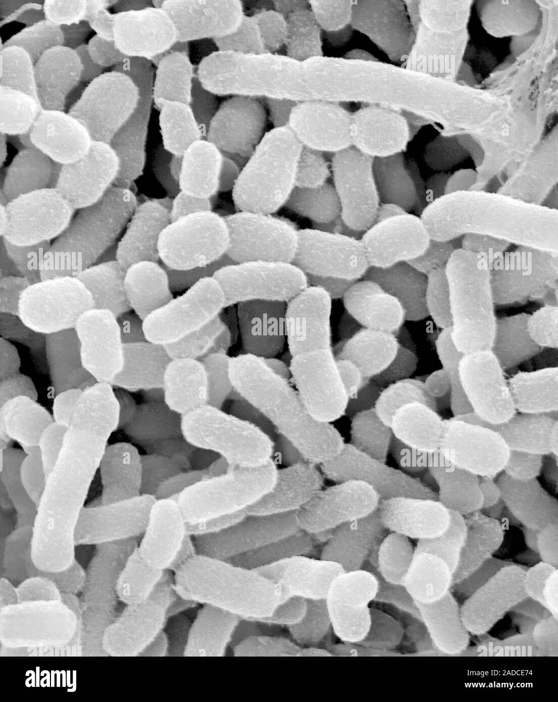 Scanning electron micrograph (SEM) of Rumen bacterium (Prevotella ruminicola). Prevotella ...
