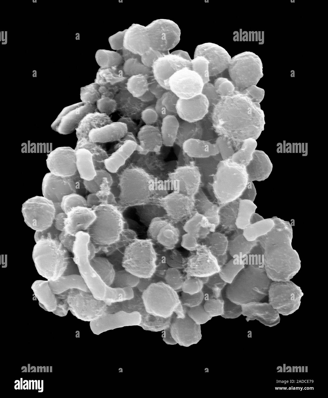 Scanning electron micrograph (SEM) of Bacteria from the human tongue ...