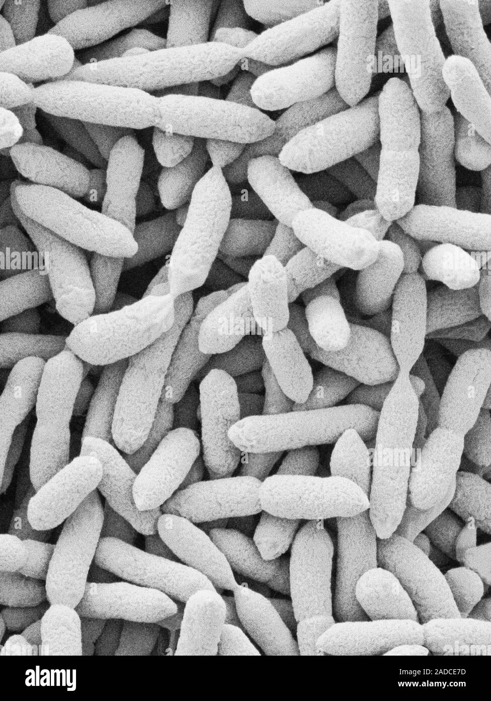 Scanning electron micrograph (SEM) of Oceanimonas baumannii, Gram ...