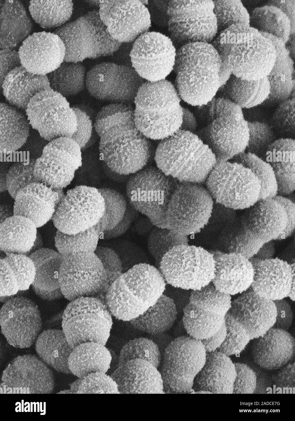 Scanning electron micrograph (SEM) of Streptococcus salivarius, Gram ...