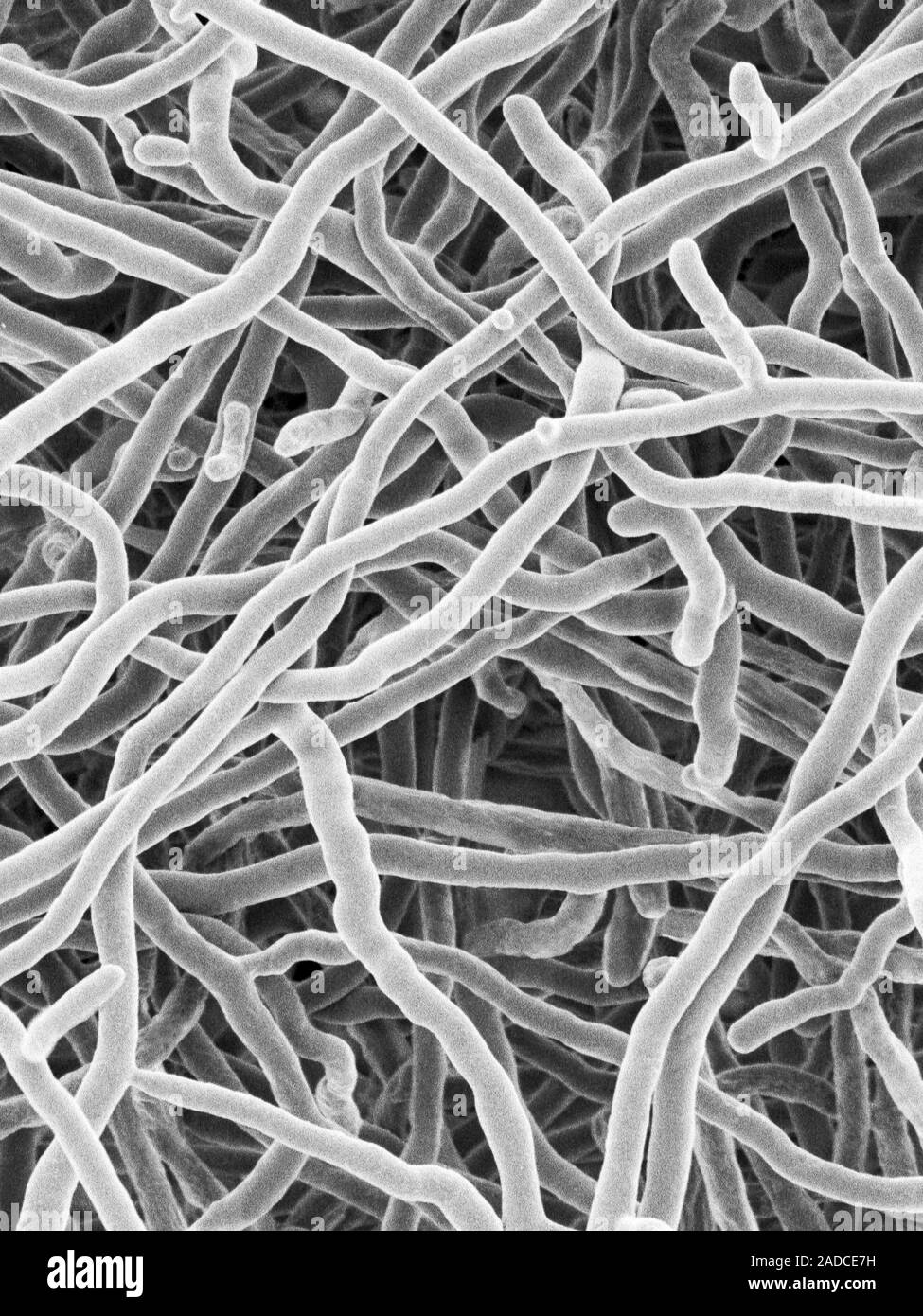 Scanning electron micrograph (SEM) of Streptomyces thermoviolaceus ...