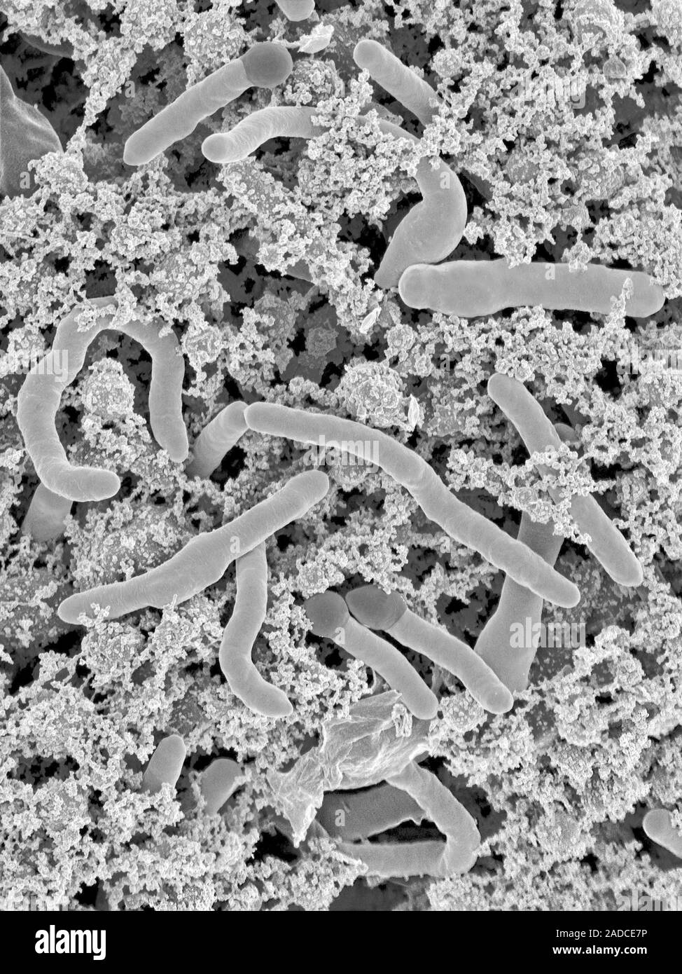Scanning electron micrograph (SEM) of Geobacillus stearothermophilus ...
