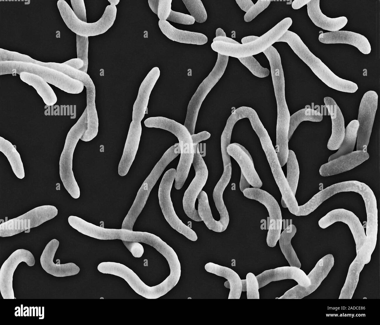 Scanning electron micrograph (SEM) of Vibrio cholerae is a Gram ...