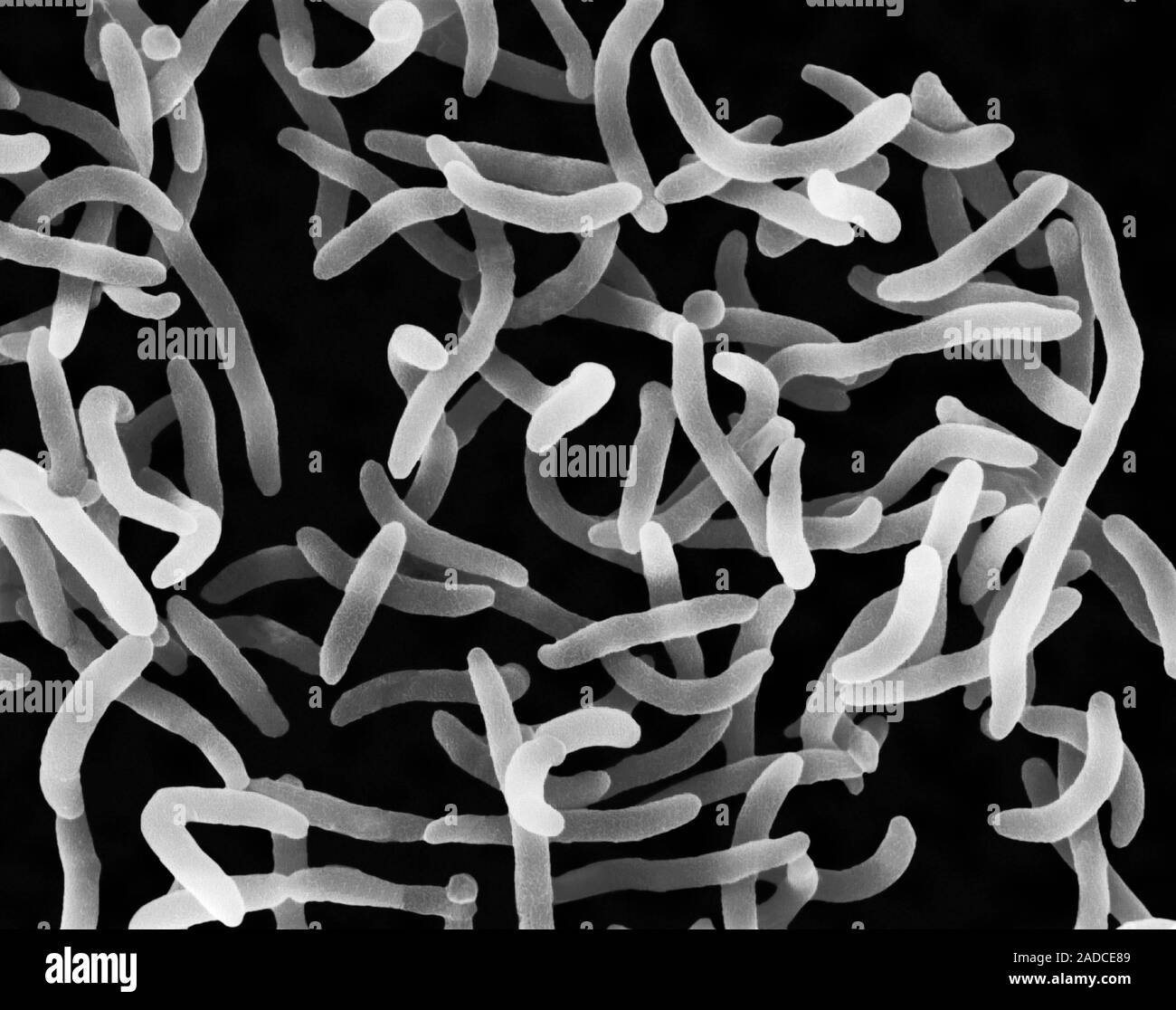 Scanning electron micrograph (SEM) of Vibrio cholerae is a Gram ...