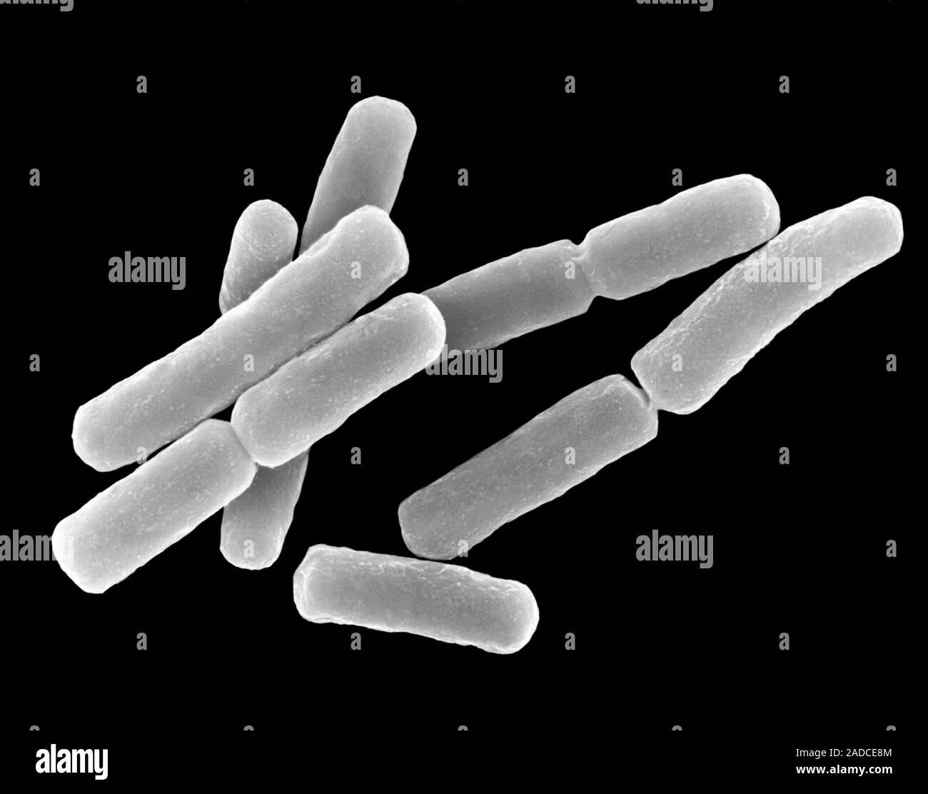 Scanning electron micrograph (SEM) of Bacillus anthracis, vegetative ...